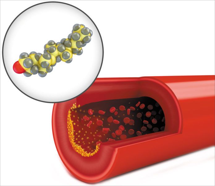 Encouraging Research Shows New Cholesterol Busters Safe, Effective ...