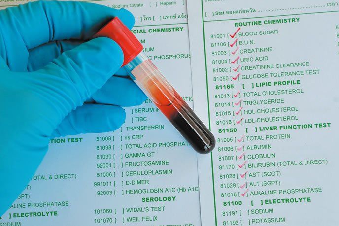 How to Decipher Your Blood Work And Know Which Tests You Need - Heart ...